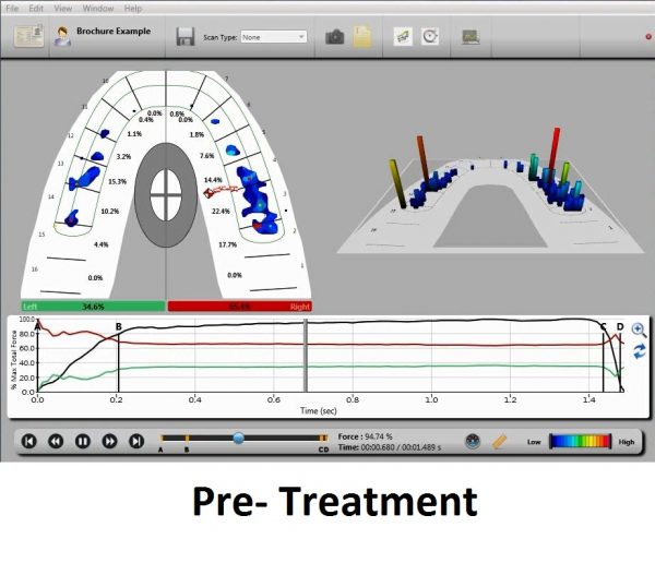 Máy phân tích khớp cắn điện toán T-Scan - 24 SEVEN HEALTH CARE VIET NAM